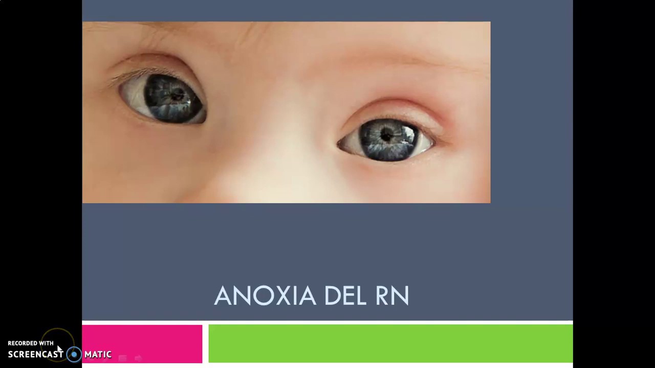 O Que é Anoxia Neonatal - RETOEDU
