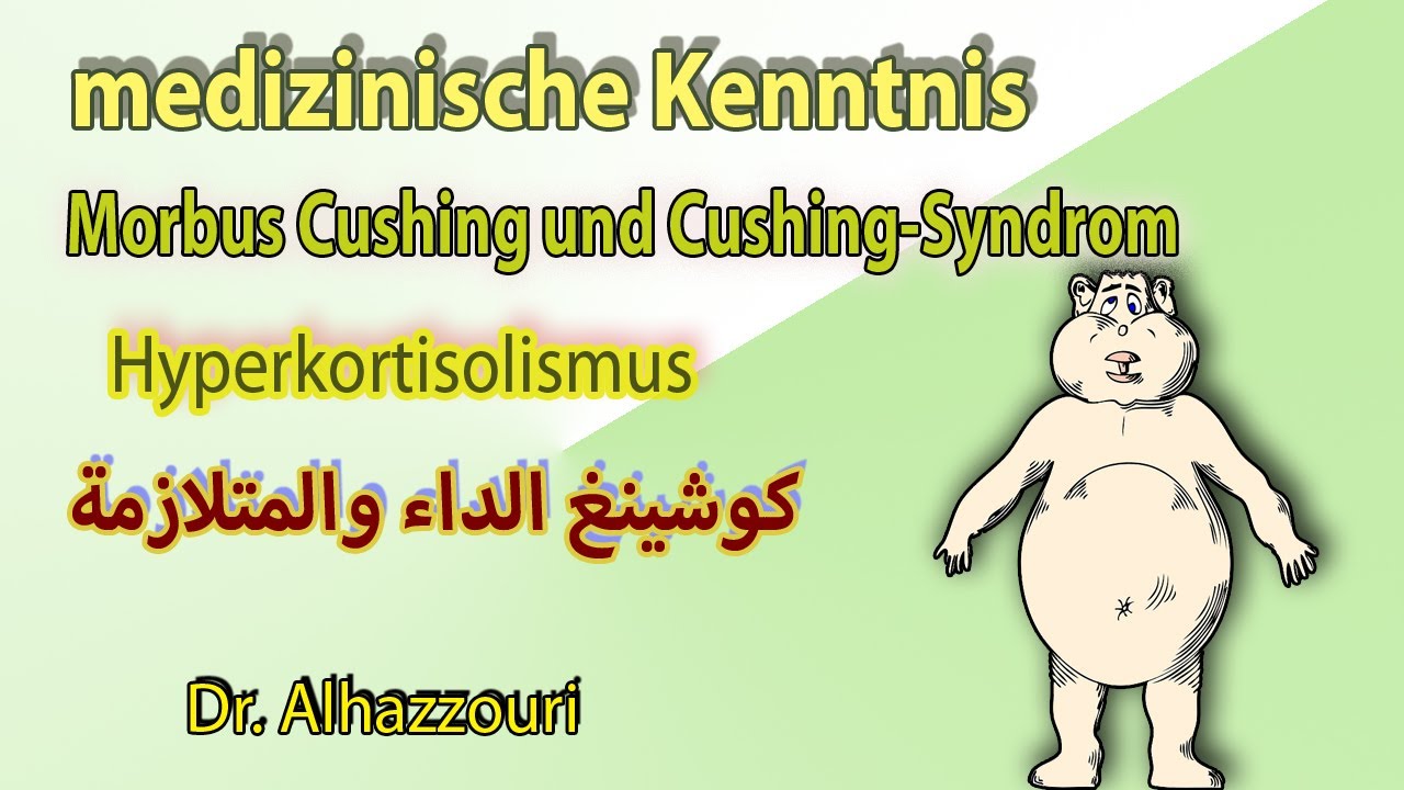 Hyperkortisolismus (Morbus Cushing und Cushing-Syndrom) - KP داء كوشينغ ...