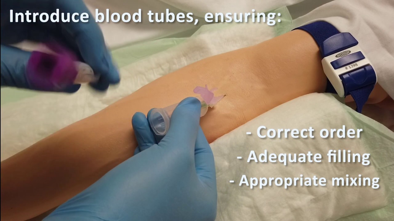 Venepuncture - Otago Medical School - YouTube