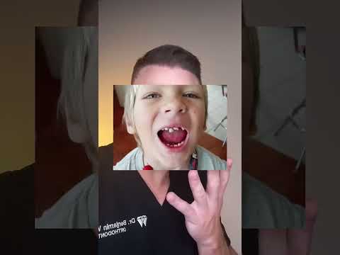 The Shocking TRUTH About Baby Teeth 🦷 - YouTube