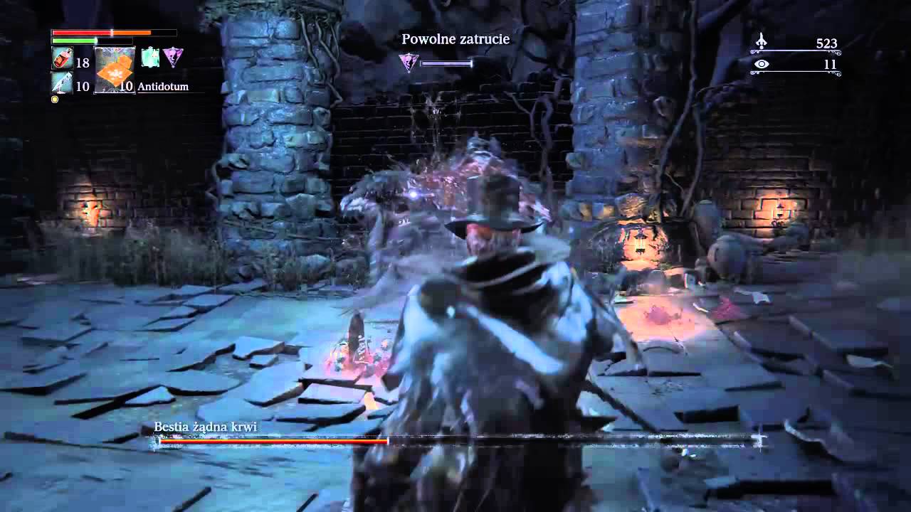 Bloodborne™ RAGE!!! - YouTube