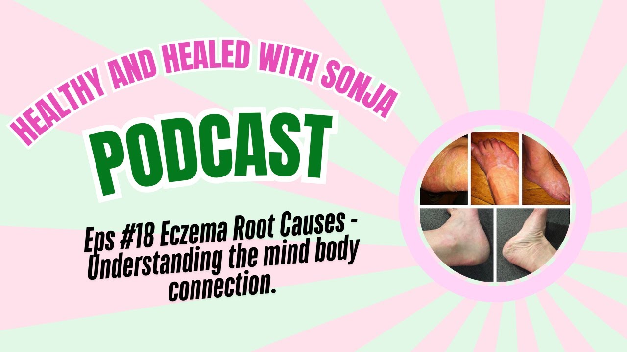 What's under your skin? - Understanding the root Causes of eczema from ...