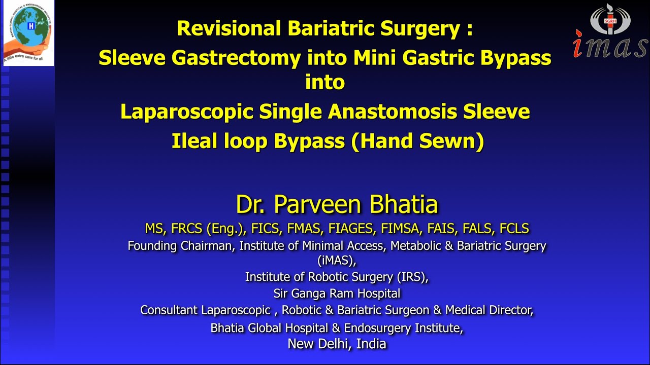 Laparoscopic Single Anastomosis Sleeve-ileal loop Bypass | Revision ...