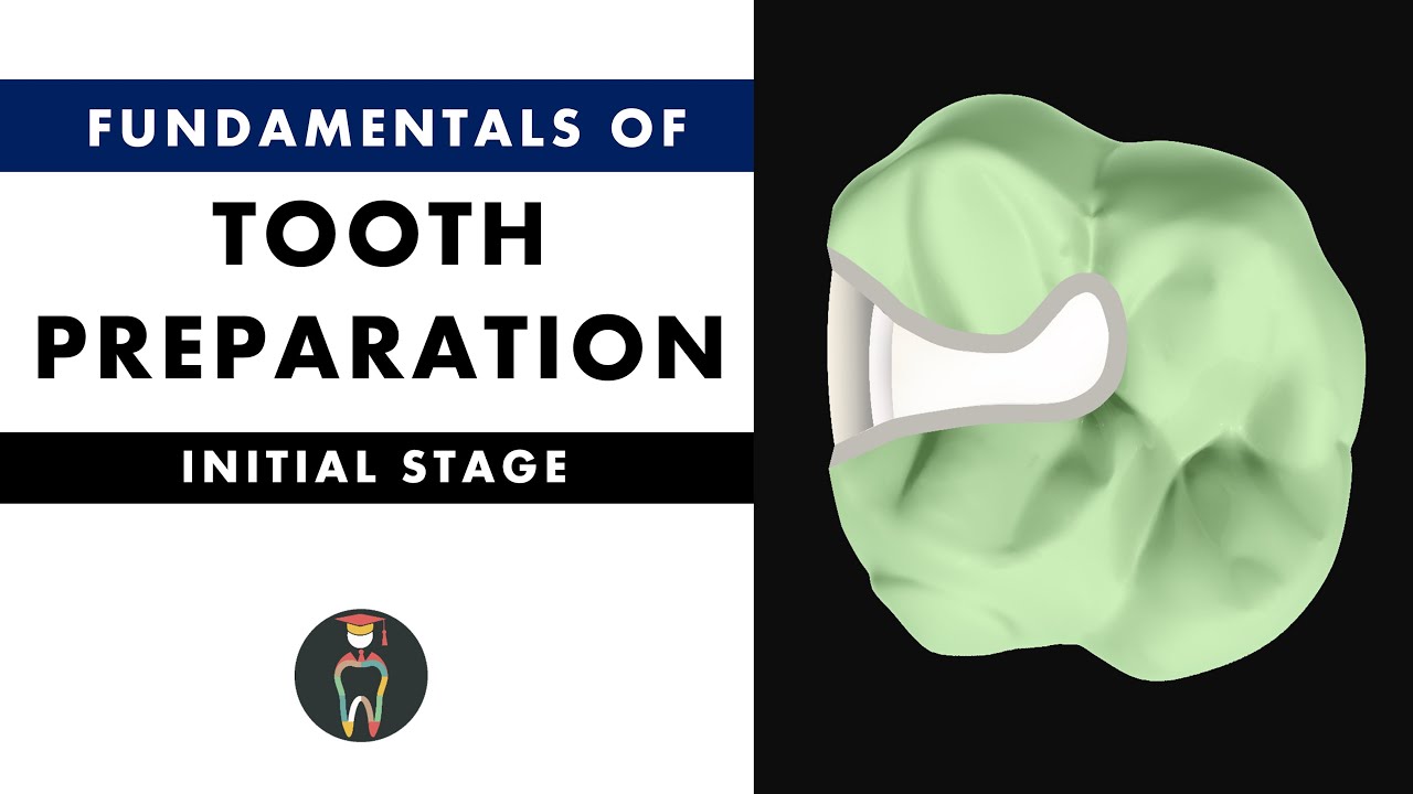 Fundamentals of Tooth Preparation | Initial Stage - YouTube