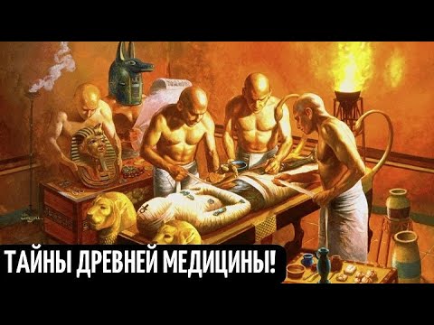 Тайны древней медицины! Загадки древних цивилизаций! Исторический ...