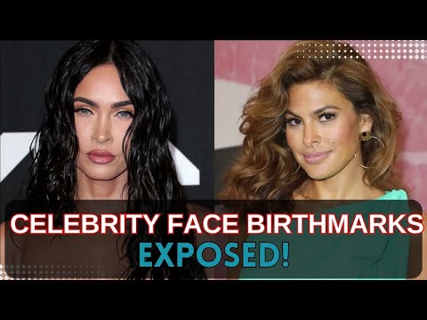 Celebrities With Birthmarks 60 Photos - Moonagedaydream.film