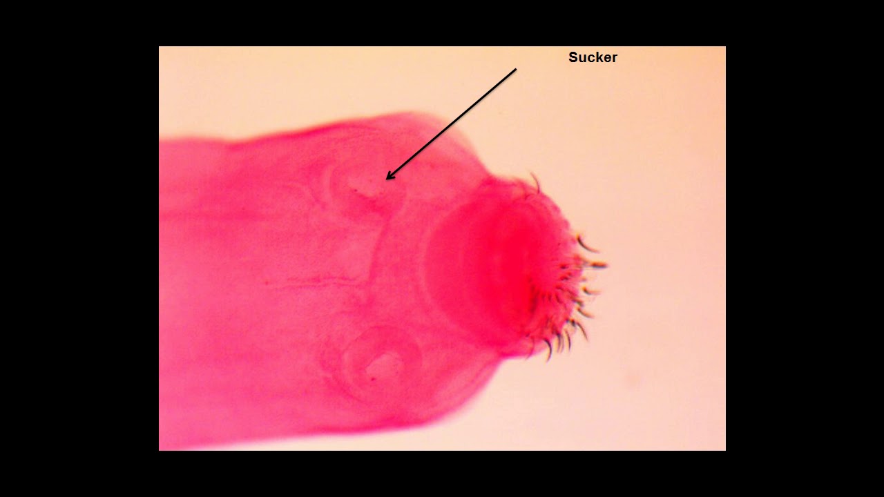 Taenia Scolex Slide