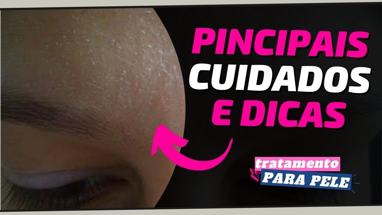 O que fazer quando a pele do rosto está descascando - YouTube