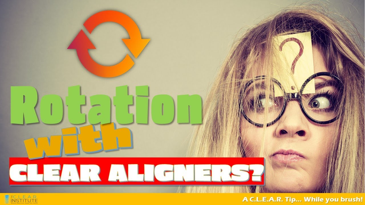 How can you rotate teeth with Invisalign clear aligners? - YouTube
