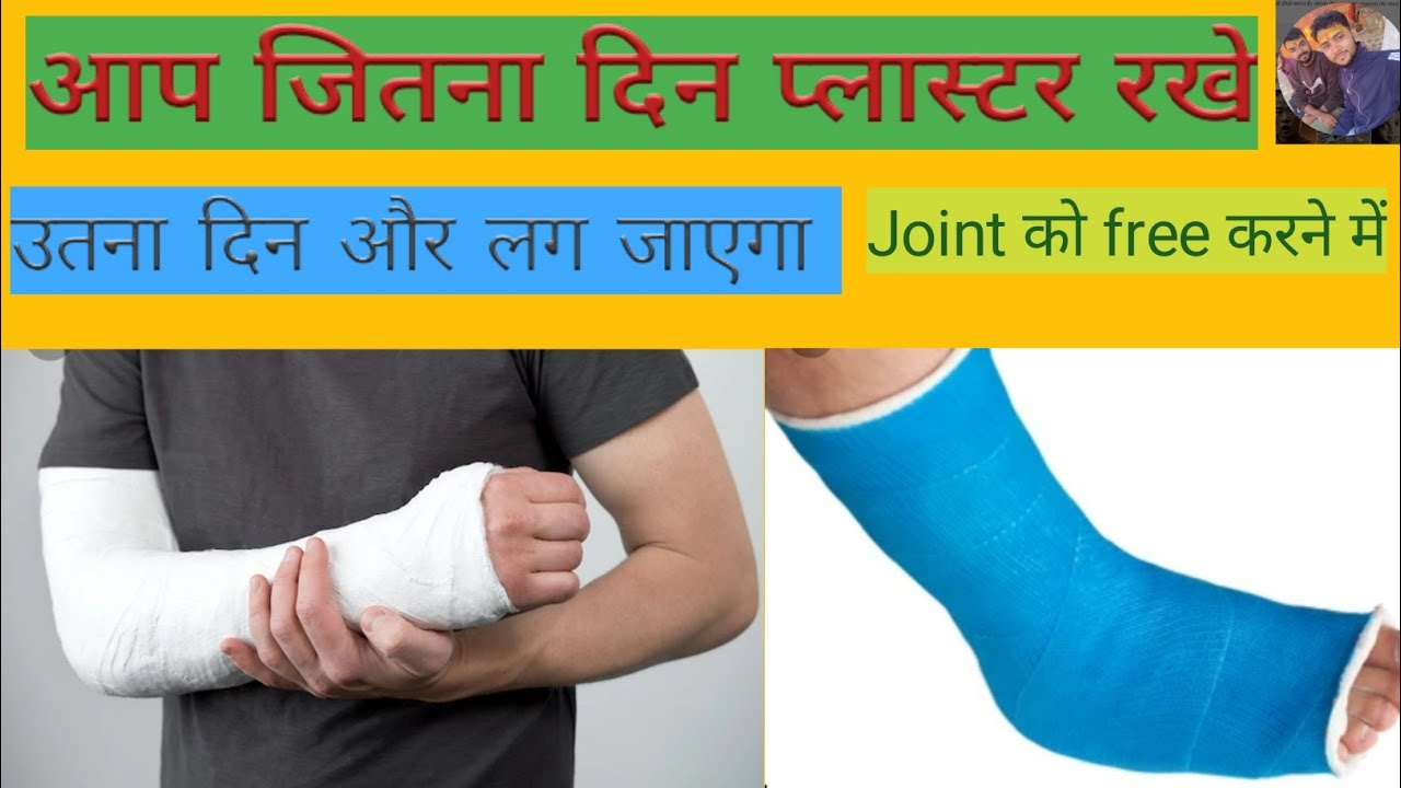 dr द्वारा sugest kiye jane par plaster 40 day tak rakhne ko bola hai ...