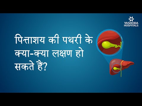 पित्ताशय की पथरी के क्या क्या लक्षण हो सकते हैं?