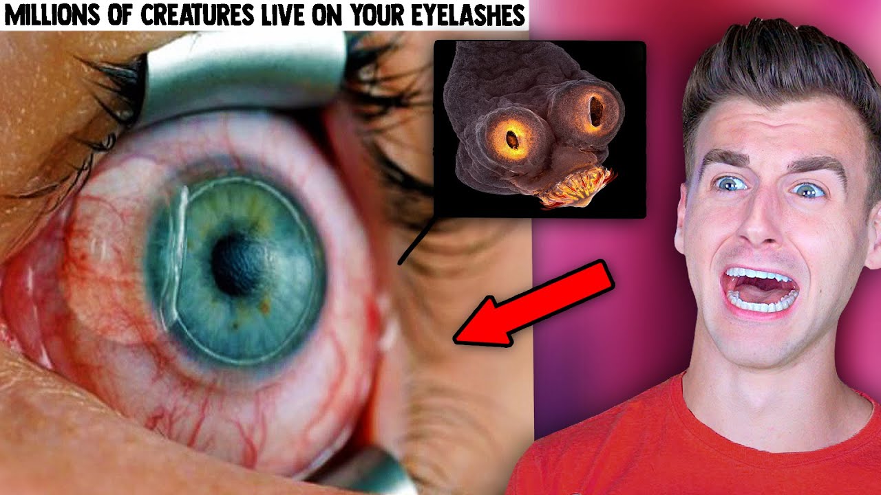 Terrifying Things You Didn't Need To Know Thanks To Microscopes - YouTube