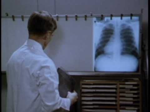 DIAGNOSIS AND TREATMENT OF THE SUBLUXATING SHOULDER - YouTube