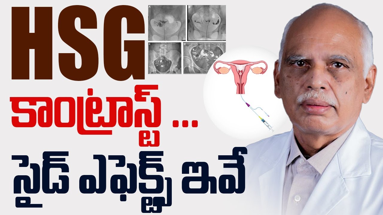 HSG Contrast Side Effects : Stories from Real Patients || Dr J ...