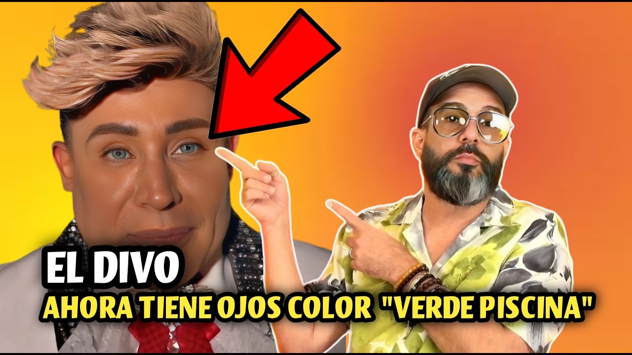 EDUARDO Antonio, “El DIVO de Placetas” ahora tiene ojos color “verde ...