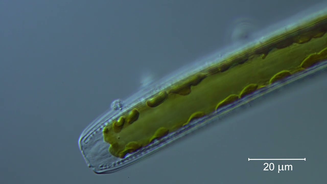 Diatom: Nitzschia sigmoidea - YouTube