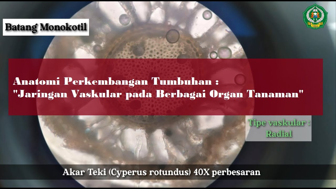 Anatomi Perkembangan Tumbuhan :"Jaringan Vaskular pada Berbagai Organ ...