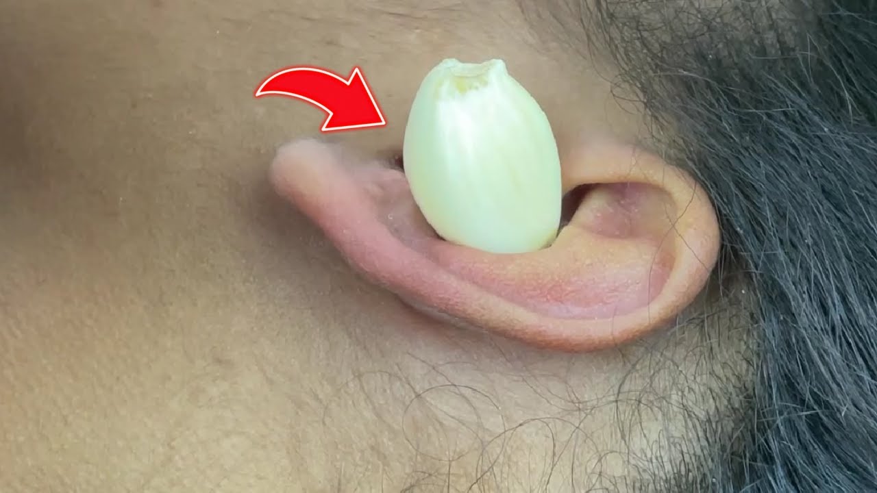 Put garlic in your ear and you will be surprised by the result - YouTube