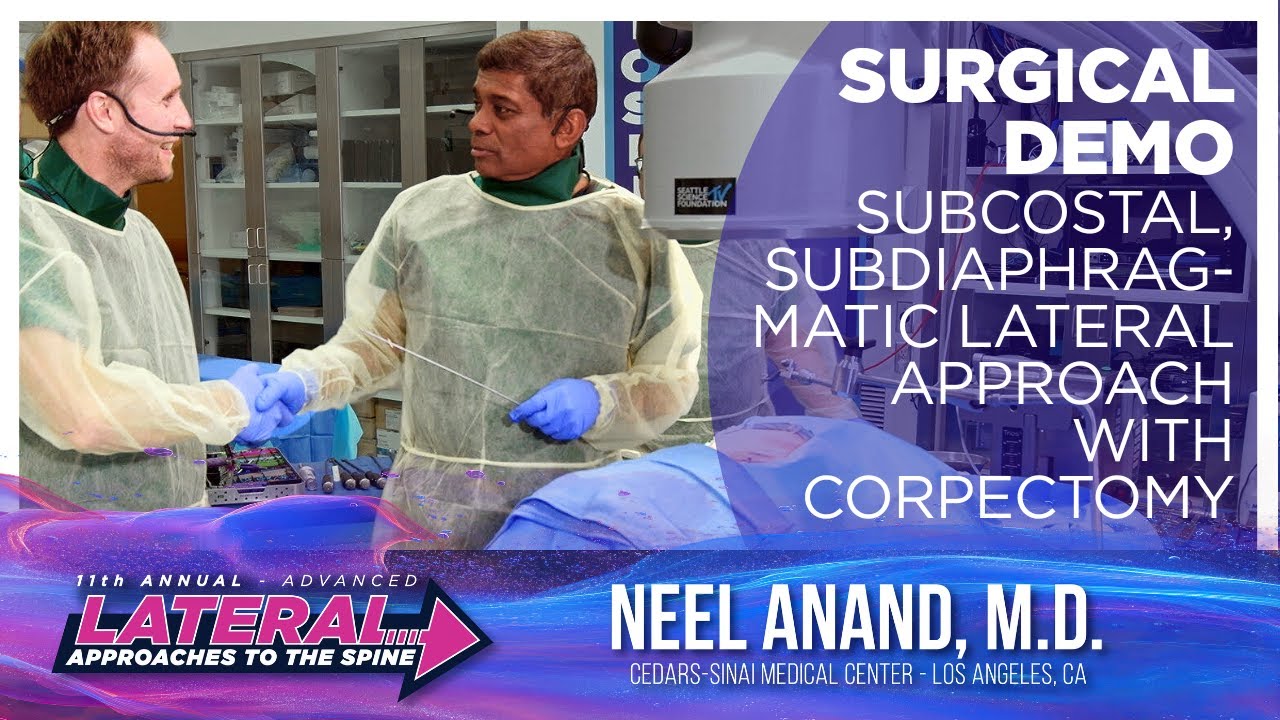 Subcostal, Sub-diaphragmatic Lateral Approach with Corpectomy - Neel ...