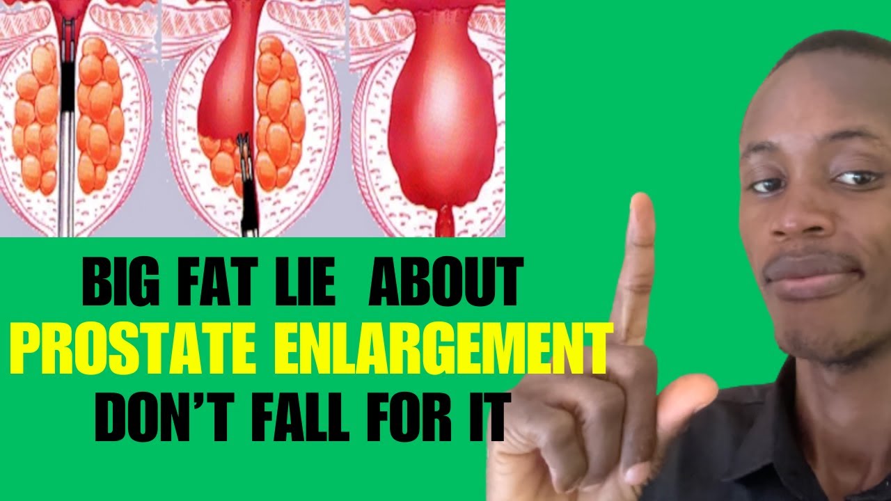 Common Myth about Enlarged Prostate (Big fat lie) - YouTube