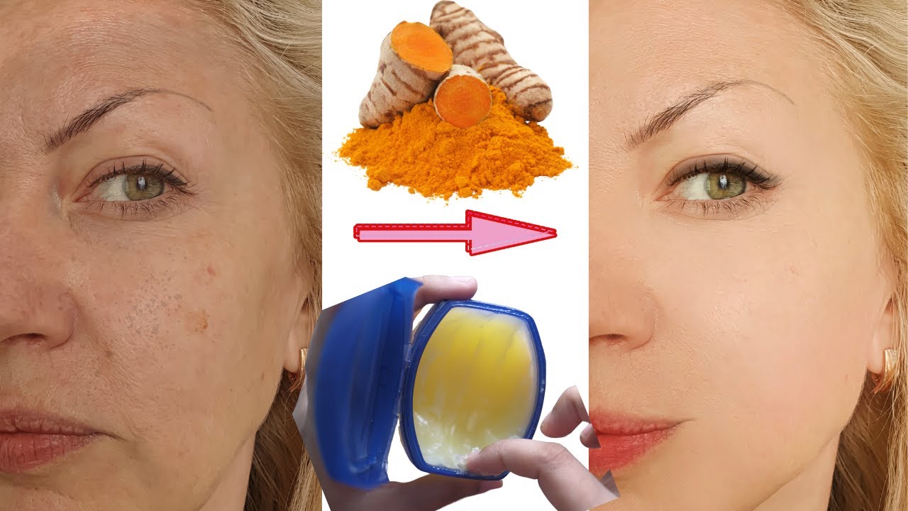 Get Rid of Dark Spots with Vaseline & Turmeric - Bright Skin in 3 Days ...