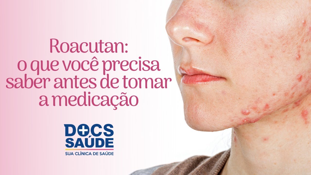 Roacutan: o que você precisa saber antes de tomar a medicação - YouTube