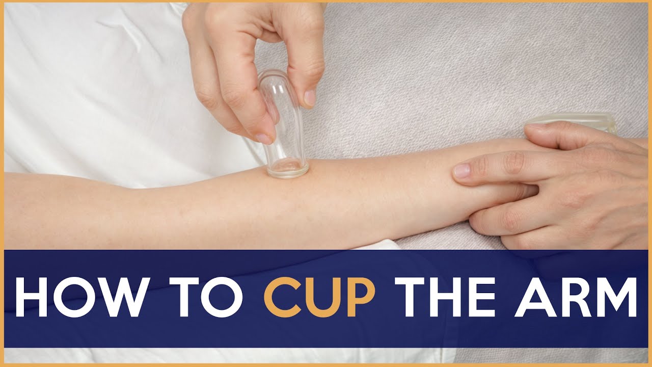 How to Cup the Arm - Myofascial Cupping on the Wrist and Forearm - YouTube