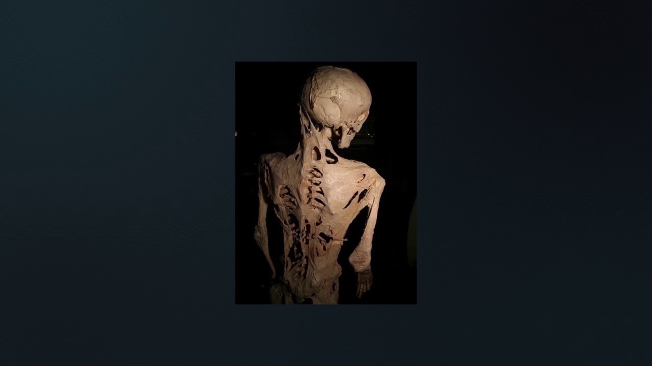 SCP Türkçe: SCP #439 - "Kemik Böceği" - YouTube