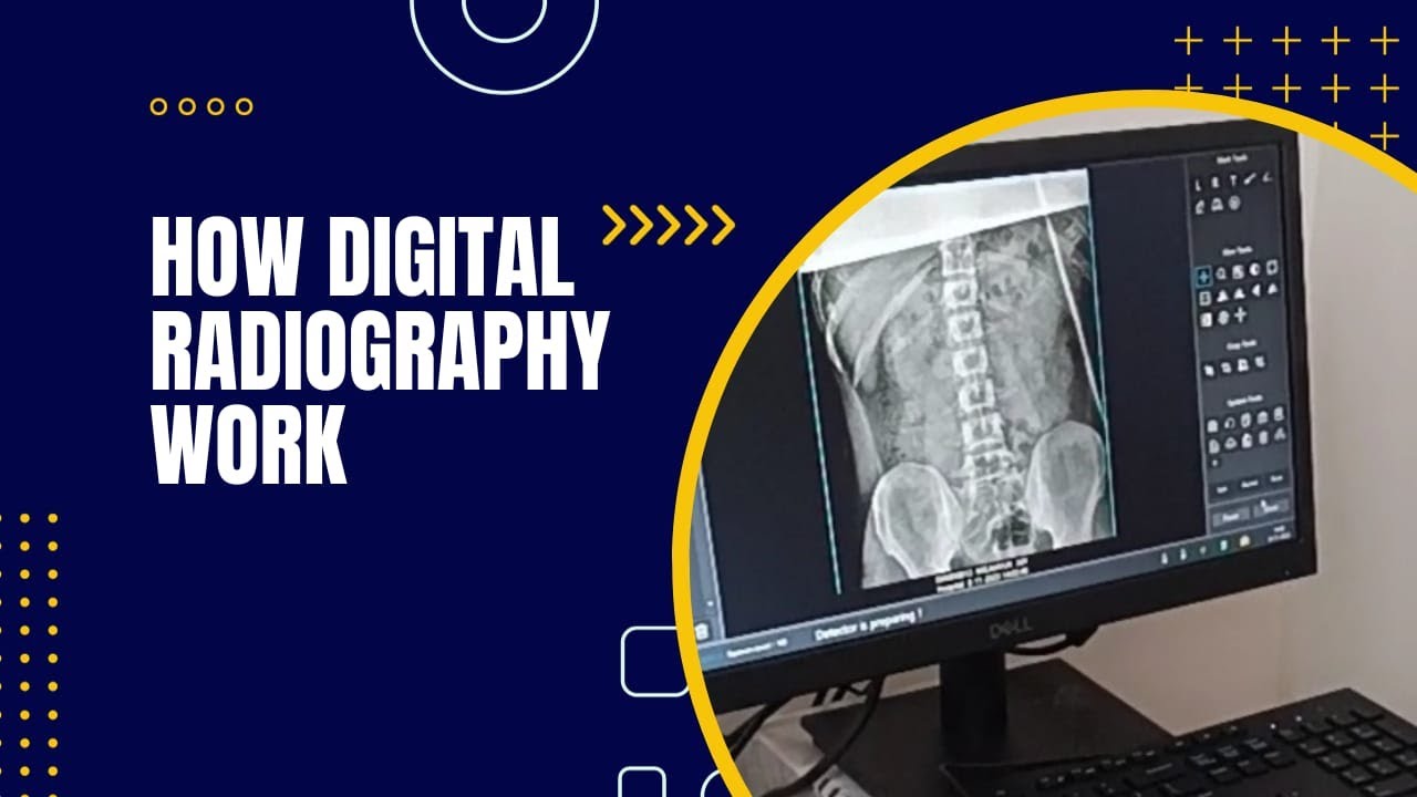 "Unveiling the Magic: How Digital Radiography Systems Work"#dr-system # ...