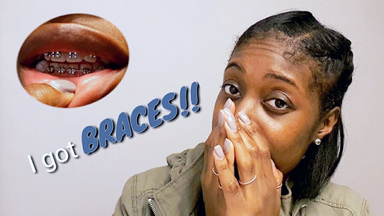 I Got Braces!? (Days 1-4) - YouTube