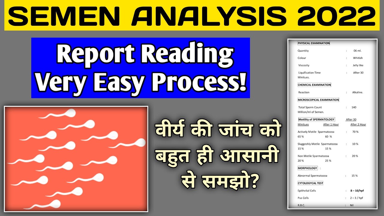 Virya Ki Report Kaise Dekhe How To Read Semen Analysis Report Semen