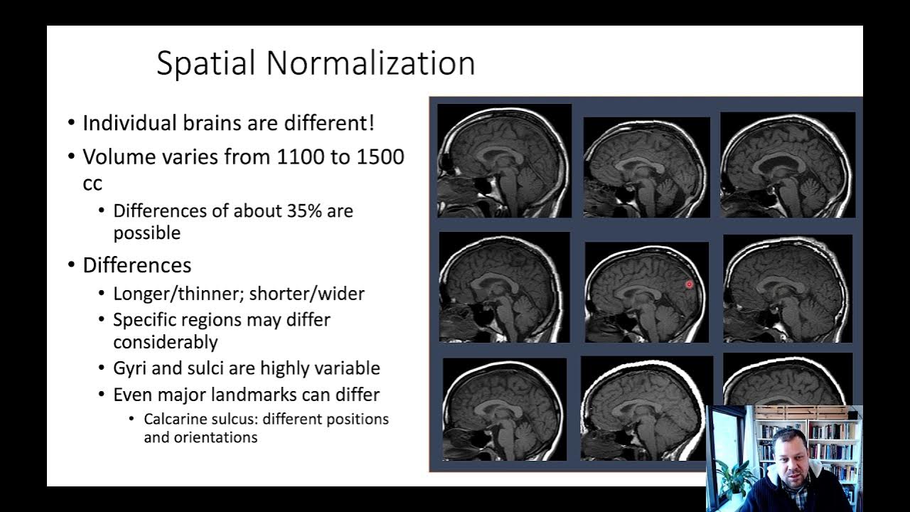 Methods_L3_1_Normalization - YouTube