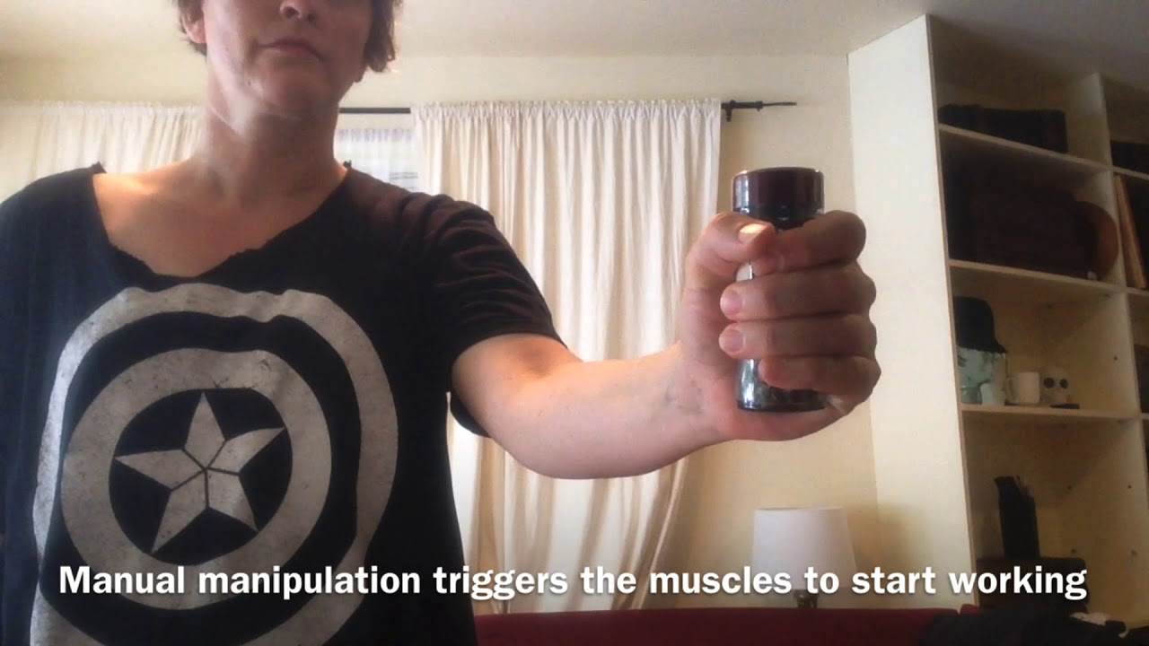 Hand Paralysis Caused By Dystonia - YouTube
