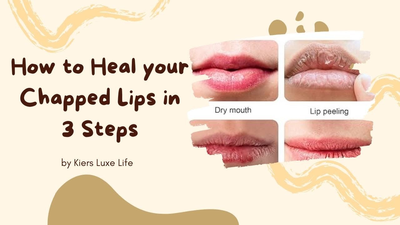 How To Heal Your Chapped Lips In 3 Steps Lipstick Lips Health Youtube