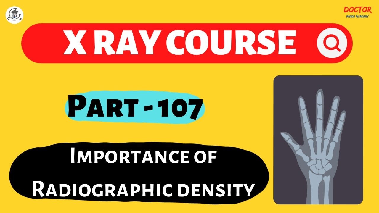 Importance of Radiographic Density | Part - 107 | X Ray Course | Doctor ...
