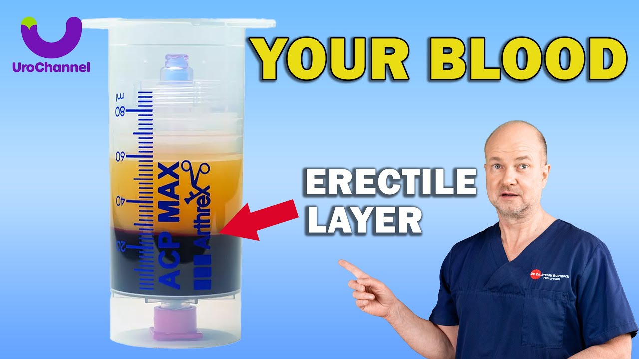 What is a P-Shot | UroChannel - YouTube