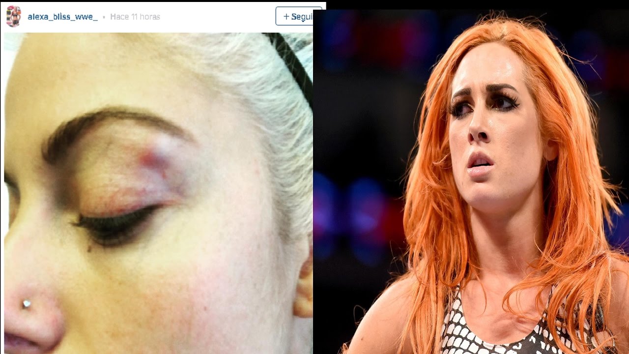 ALEXA BILLS SE AUTOLESIONA, BECKY LYNCH DISCRIMINADA POR EJECUTIVO ...