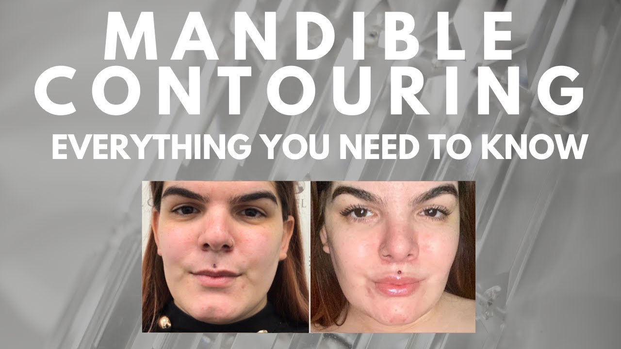 All About Mandible Contouring from World-Leading FFS Surgeon - YouTube