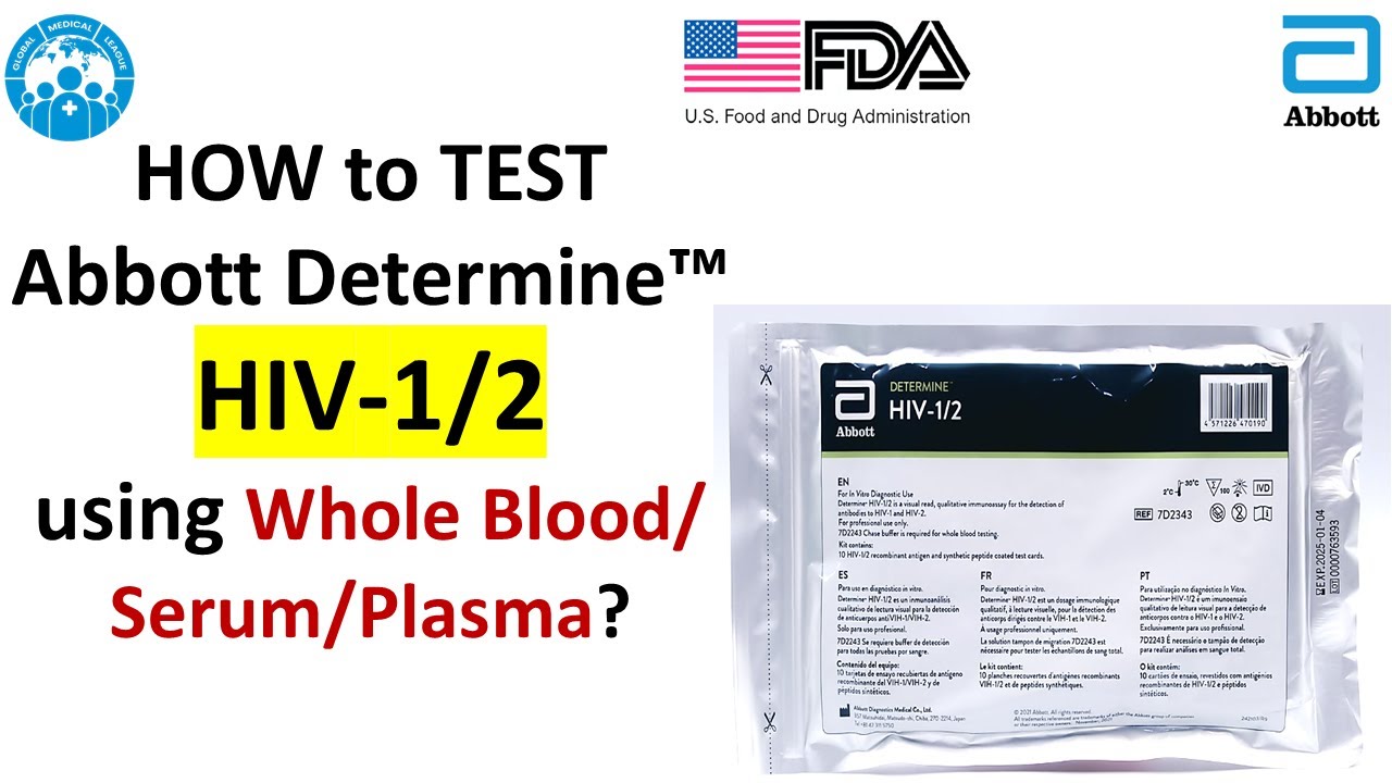 How to Test Abbott Determine™ HIV-1/2 using Whole Blood / Serum ...