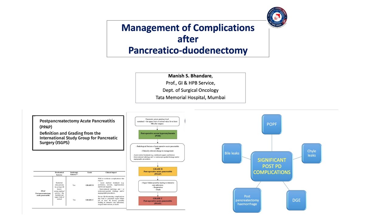 Managing Complications after Pancreatico-duodenectomy - YouTube
