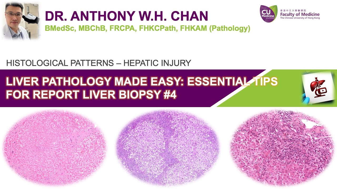 Liver Pathology Made Easy (4/7) - Essential Tips for Reporting Medical ...
