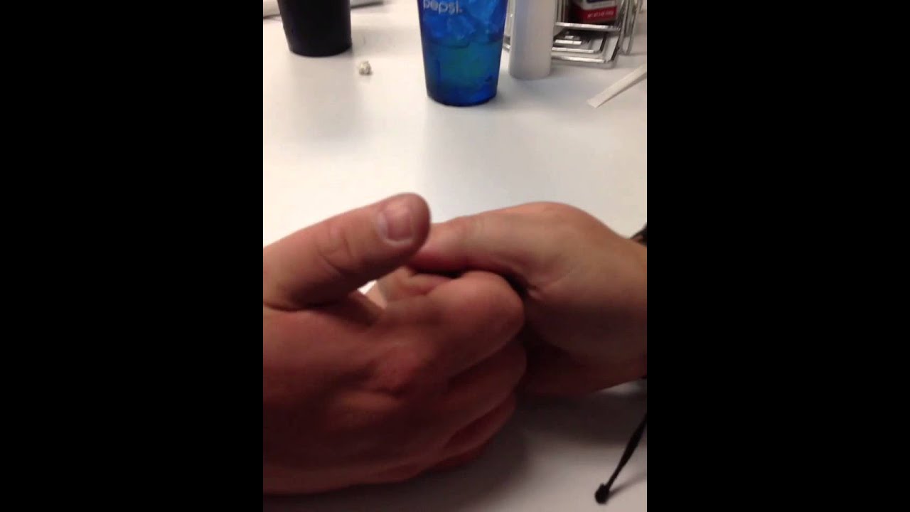 Thumb war - YouTube