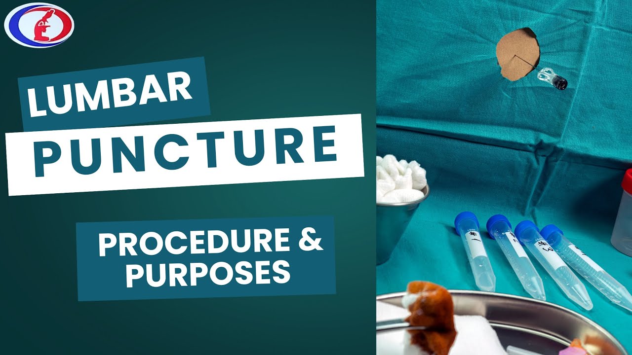 Lumbar Puncture (Spinal Tap): Procedure, Uses & Risks - YouTube