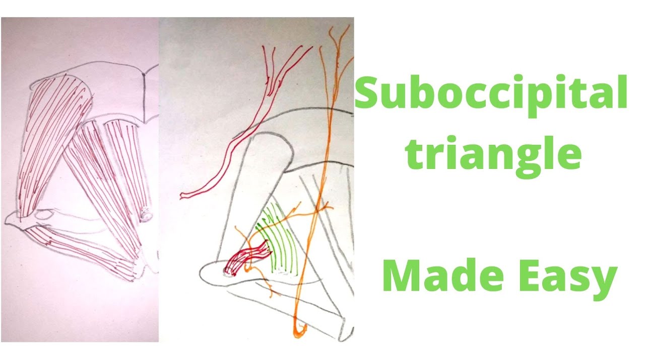 Suboccipital triangle (Suboccipital muscles)A triangle present deep to ...