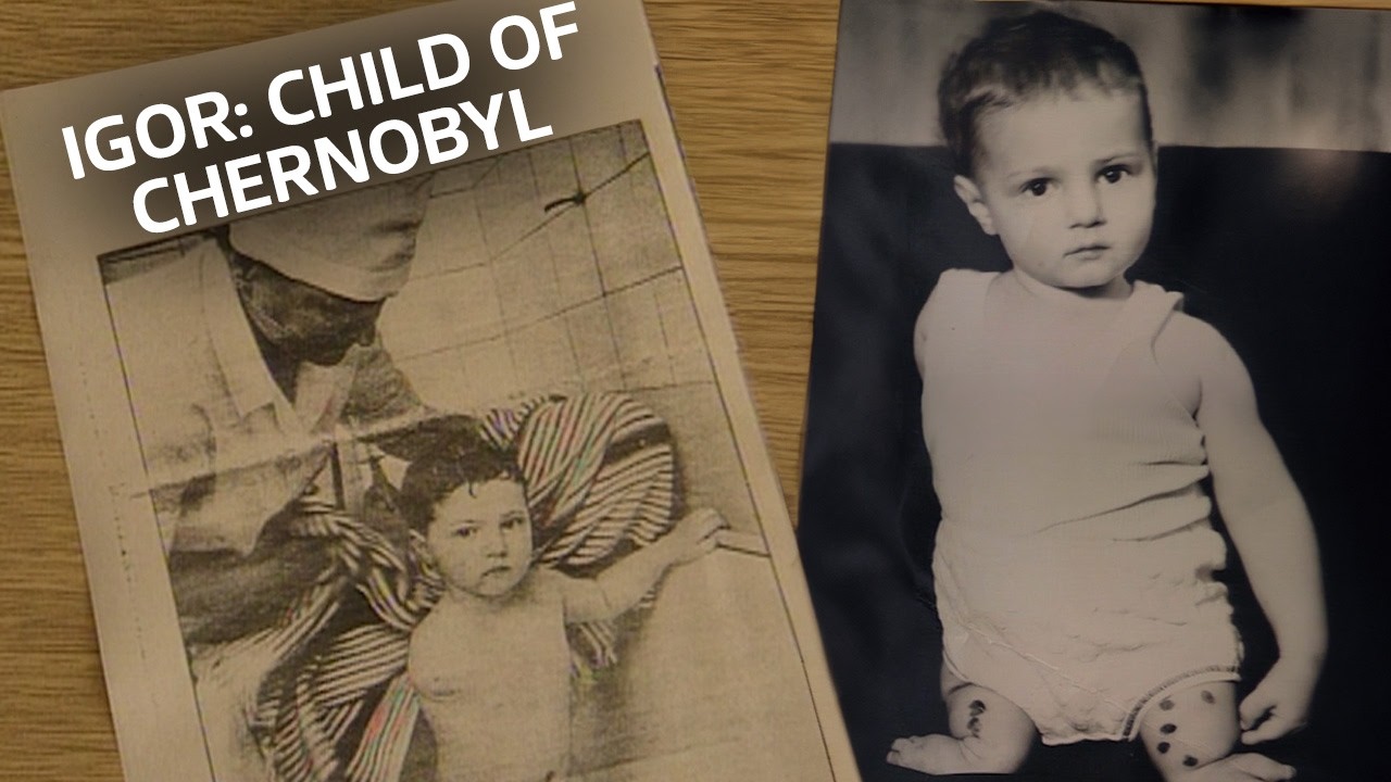 Child of Chernobyl: The Incredible Journey Of Eight-year-old Igor ...