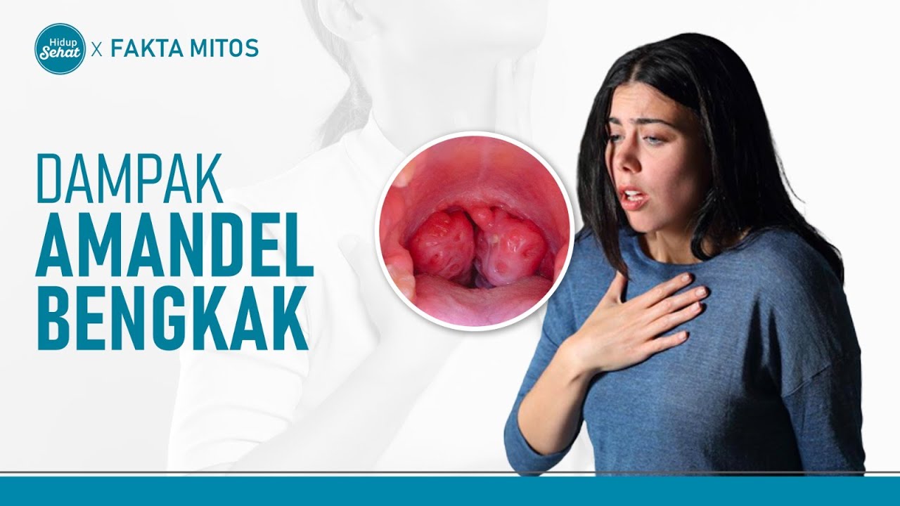 Dampak Amandel Bengkak Pada Kesehatan Tubuh | Hidup Sehat tvOne - YouTube