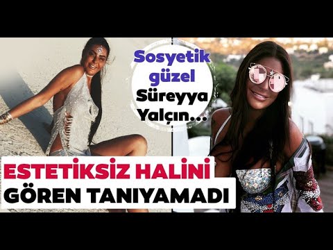 Süreyya Yalçının estetiksiz hali şoke etti Süreyya Yalçını hiç boyle gormediniz