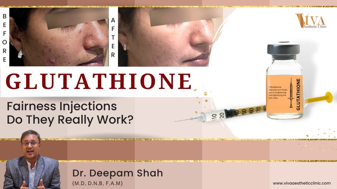 Glutathione Skin Whitening Injection | Glutathione Benefits | Fairness ...