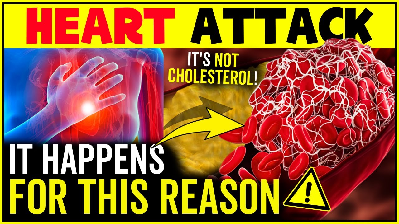 Almost All Heart Attacks Happen For This Reason: It's Not Cholesterol ...