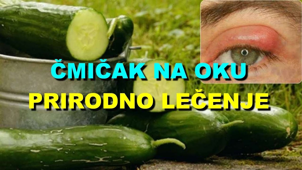 ČMIČAK Na OKU - PRIRODNO LEČENJE - YouTube